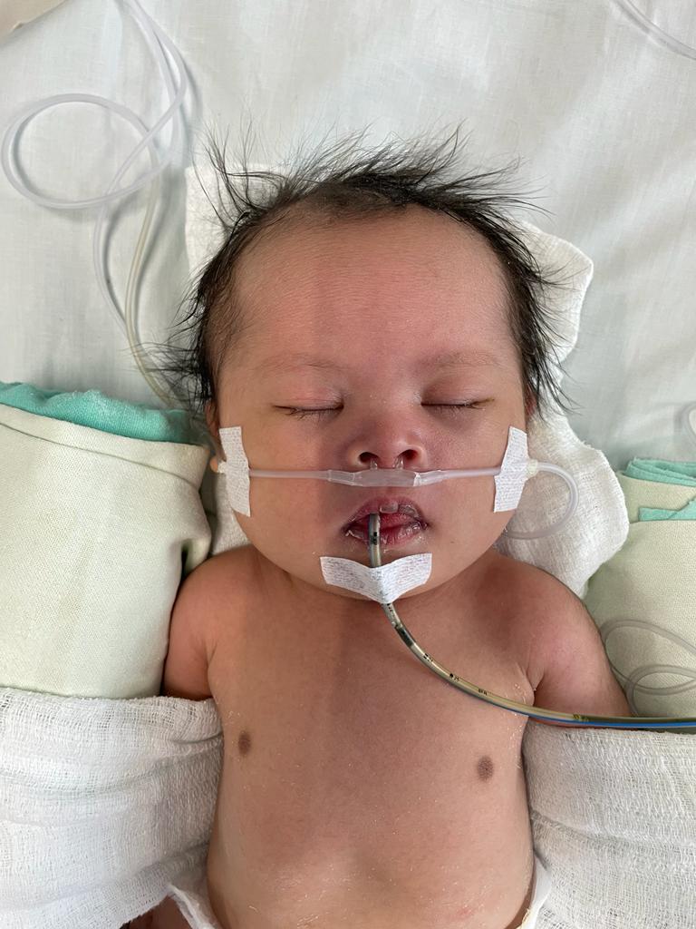 Emergency operation required for 9-day old baby